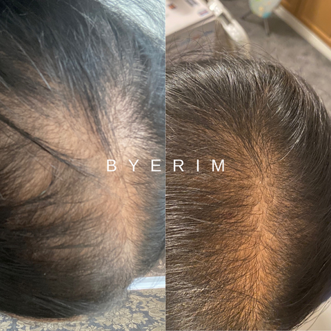ByErim | Luxury Hair and Beard Care Products