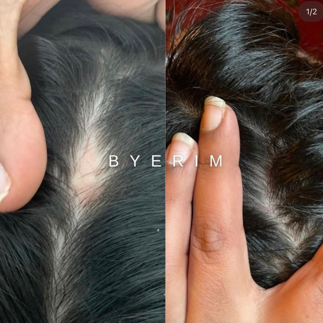 Natural Hair Oil & Beard Growth Products | Award-Winning | ByErim